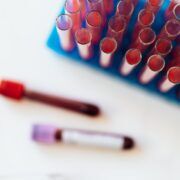The Golden State Killer: A Definitive Forensic Case Study - Simplyforensic